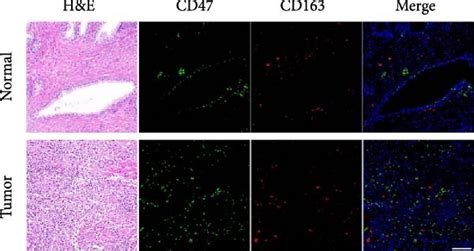Spatially Distribution And Accumulation Of Cd47 And Macrophages In Download Scientific Diagram