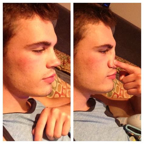 Nose Cartilage
