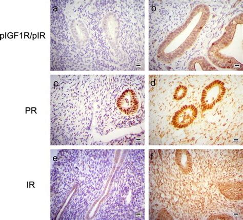 Insulinigf And Sex Hormone Axes Protein Expression In Endometrium In