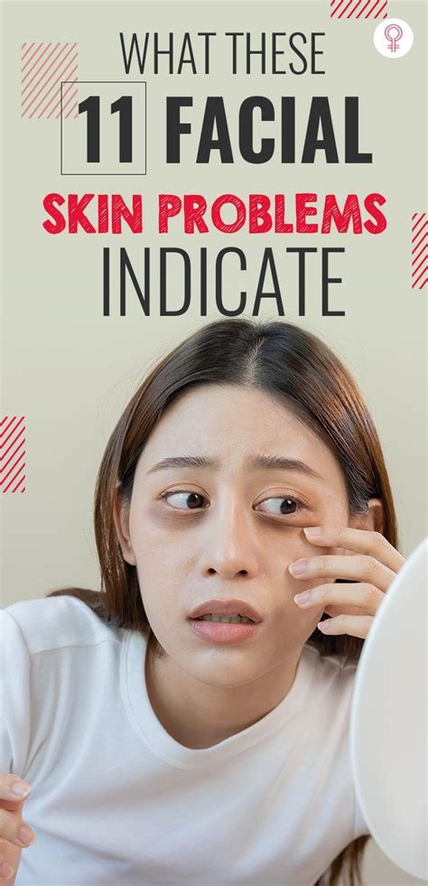 What 11 Facial Skin Defects Are Trying To Tell You About Your Health