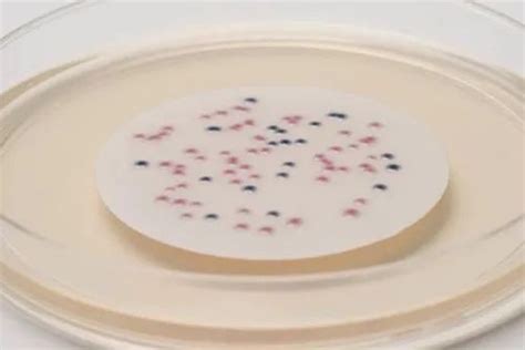 Coliform Testing Services At ₹ 501 Sample In Kolkata