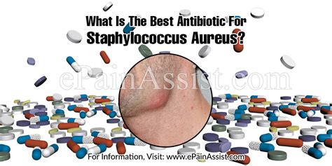 What Is The Best Antibiotic For Staphylococcus Aureus