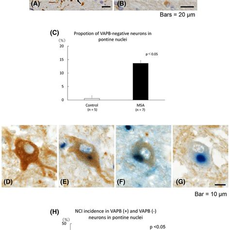Immunoreactivity Of Vesicle‐associated Membrane Protein‐binding Protein