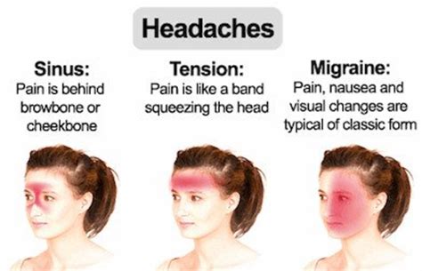 Headache Moving Around Head At Wilbur Pritt Blog