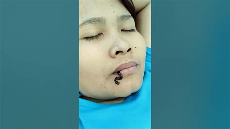 Cacing Masuk Mulut Mengerikan Youtube Music