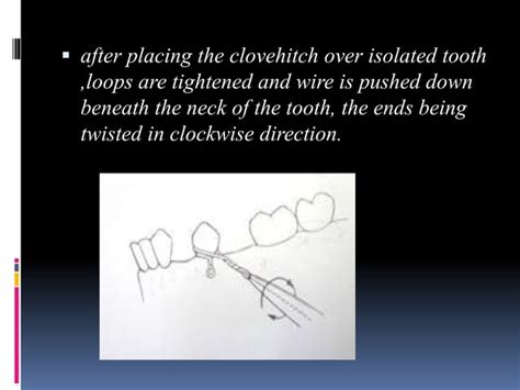 Various Intermaxillary Fixation Techniques Pptx