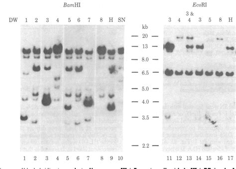 Figure 1 From Detection Of Hla Ddr Related Dna Polymorphism In Hla D