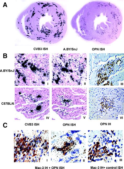 Osteopontin Circulation Research