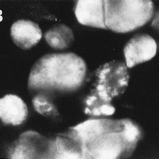 Morphological Analysis Of Floating Cells H After Gy Of Download Scientific Diagram