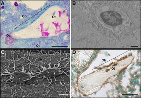 Cell To Cell Interactions Among Osteoclasts Osteoblasts And