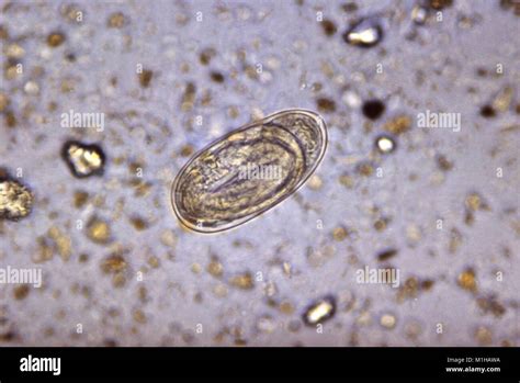Photomicrograph Of An Embryonated Hookworm Egg Ancylostoma Duodenale