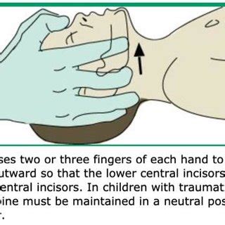 Jaw Thrust Maneuver Download Scientific Diagram