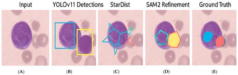 A Hybrid Deep Learning Framework For Accurate Cell Segmentation In Whole Slide Images Using