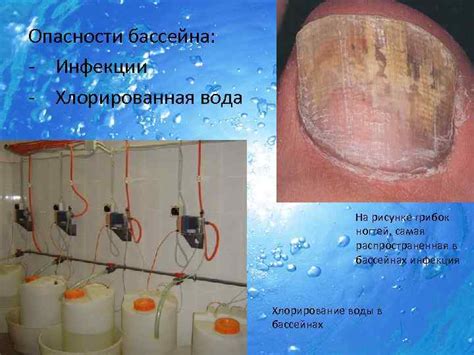Опасность водноспортивных комплексов Общественный бассейн-