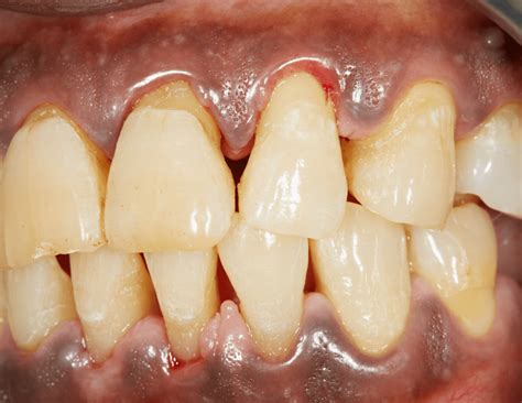 History And Physical Examination In Hematology Classical Hematology