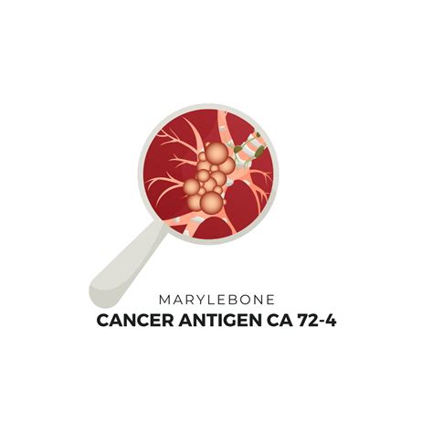 Cancer Antigen Ca 72 4 Marylebone Diagnostic Centre