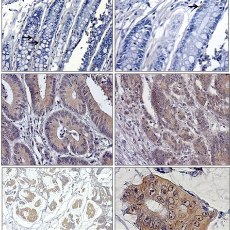 Examples Of Cd133 Immunohistochemical Staining In Human Colon Samples