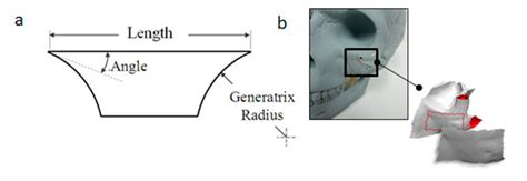 A Pyramidal Frustum B Cheekbone Geometry Download Scientific Diagram