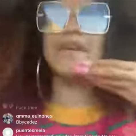Cardi B Said Her Decision To Get Plastic Surgery Is Costing Her