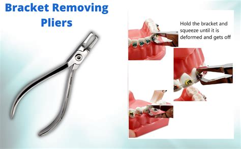 Braces Removing Bracket Removing Ligature Tie Removal