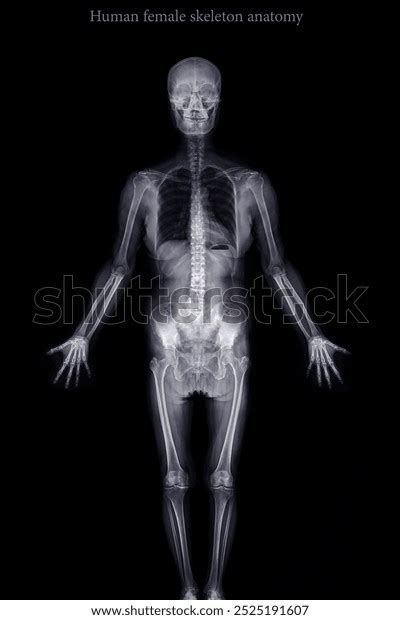 Xray Skeleton The Ultimate 3d Tool For X Ray Positions And Views