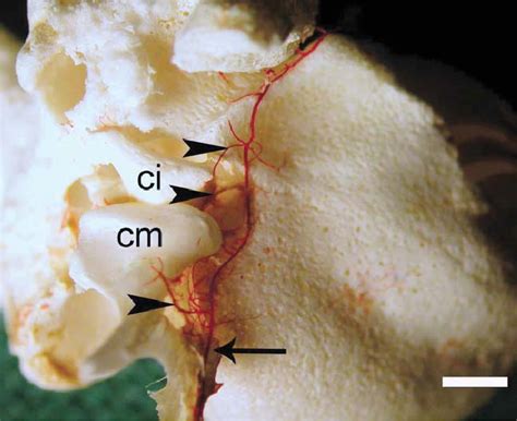 Course Of Anterior Tympanic Artery And The Structures Supplied By This