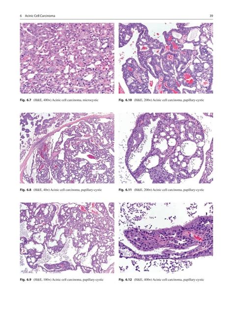 Atlas Of Salivary Gland Pathology Pdf