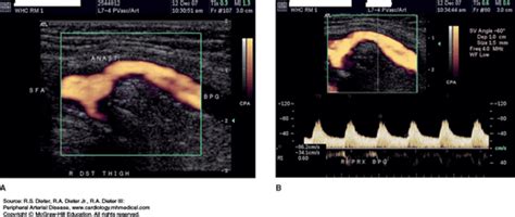 Noninvasive Arterial Imaging Thoracic Key