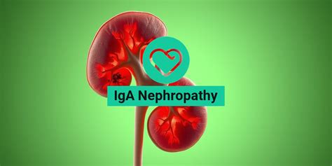 Iga Nephropathy Understanding Symptoms Causes And Treatments • Yesil