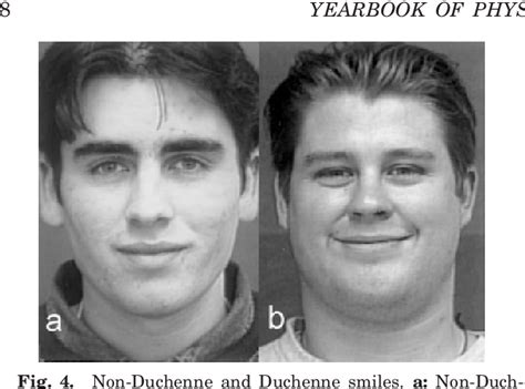 Duchenne Smile