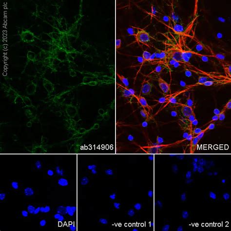 Map2抗体[hm 2] Neuronal Marker Ab11267 Abcam中文官网