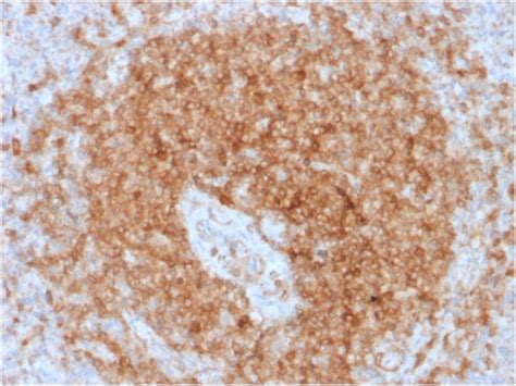 Cd79a B Cell Marker Monoclonal Antibody Riga764 973 Msm11 P0