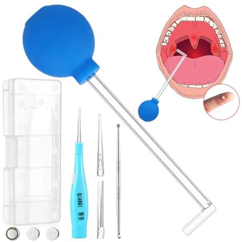 I Tested The Tonsil Stones Cupping Tool My Personal Experience And