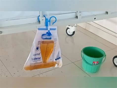 Urometer Romsons At ₹ 80piece Urine Bag In Surat Id 2851827540348