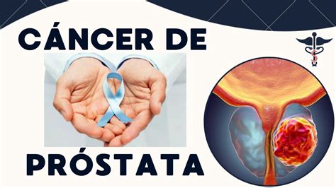 CÁncer De PrÓstata 🚨 Que Es Síntomas Como Prevenirlo Y Mucho Más 🧑‍⚕
