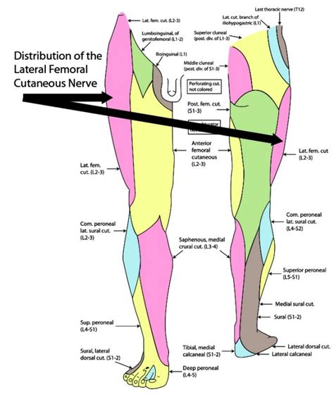 Lateral Femoral Nerve Impingement Fuzgtu