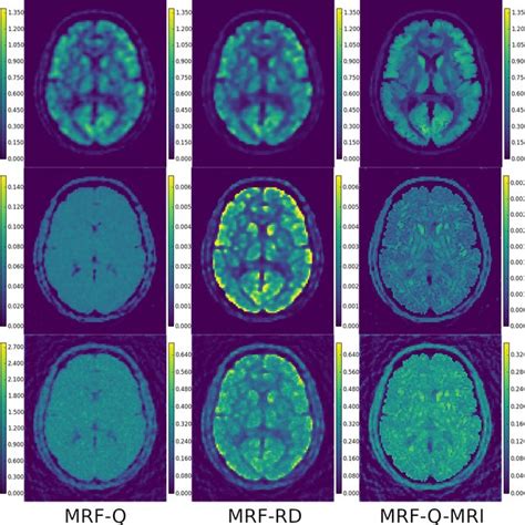 Posterior Distribution Voxel Wise Posterior Mean Posterior Variance