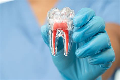 The Root Canal Process From A To Z New York Dental Office New York