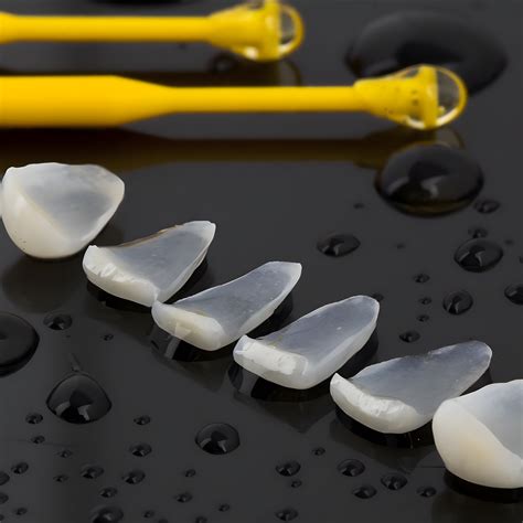 Porcelain Veneers In Houston Tx Instyle Dental Group