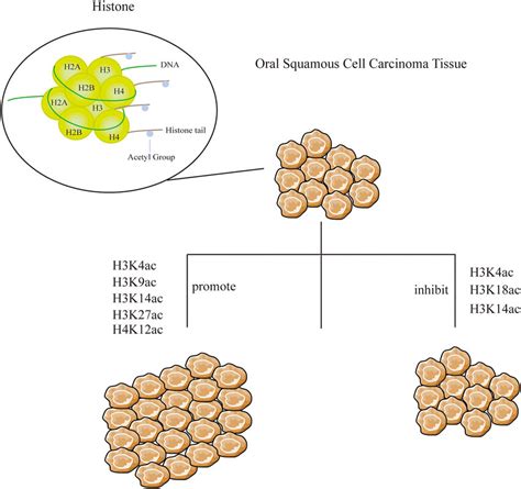 Acetylated Of Histone In Oscc On The Left Are Histone Acetylation