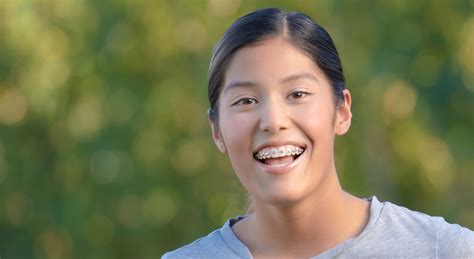 Damon Clear Braces Clear Braces Foothill Foothill Invisalign Holladay Orthodontics