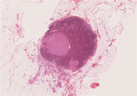 standardized cyclegan training for unsupervised stain adaptation in