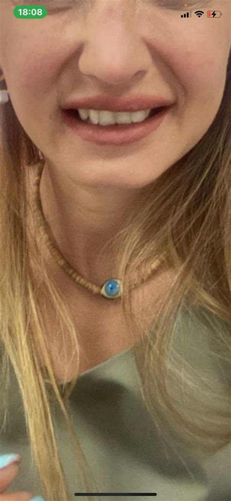 Dr Selçuk Köroğlu Massater Botoks Şikayetim Şikayetvar