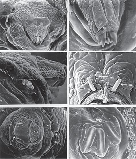 Third Instar Larva Of R Limbata Cephalic Segment And Prothorax Download Scientific Diagram