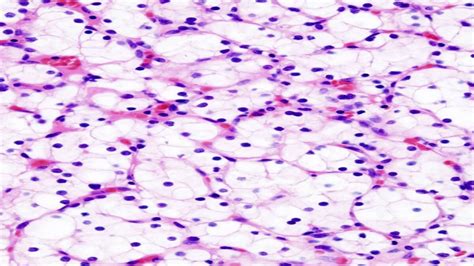 Hematoxylin And Eosin Hande Staining Principle Procedure And Interpretation