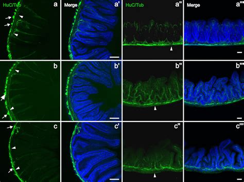 Myenteric Plexus Of The Nothobranchius Furzeri Intestine Huc And