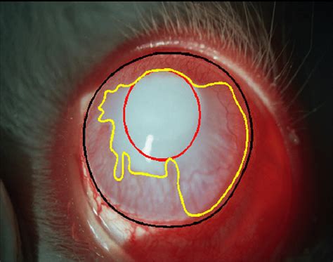 Corneal Neovascularization Areas Were Calculated On Photographs Using Download Scientific