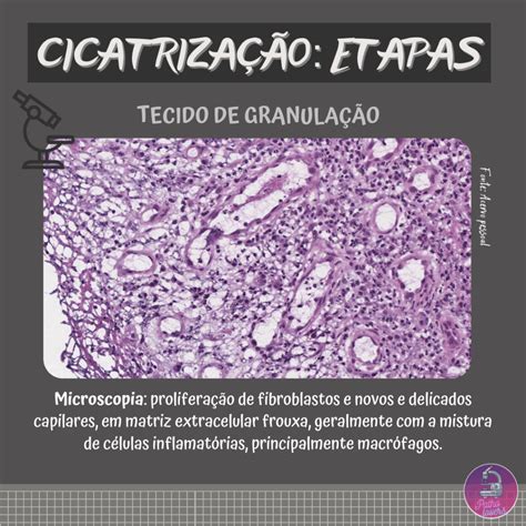 Histologia Do Tecido De Granulacao