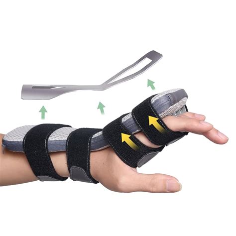 Radial Head Fracture Splint
