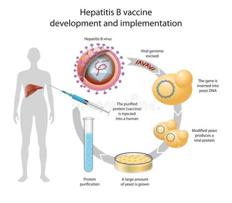 Hepatitis B Vaccine Development And Implementation Stock Illustration